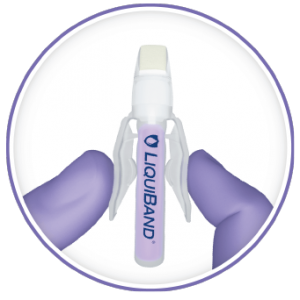 LiquiBand® Exceed™ - Controlled Wound Closure